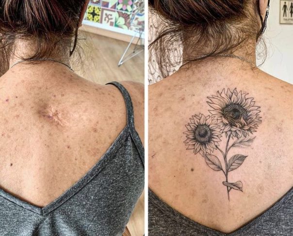 16 Iconic Transformations Of Scars Into Beautiful Tattoos