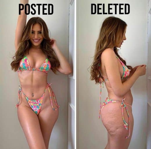Normalizing Normal Bodies: Influencer Shares 'Unedited' Photos