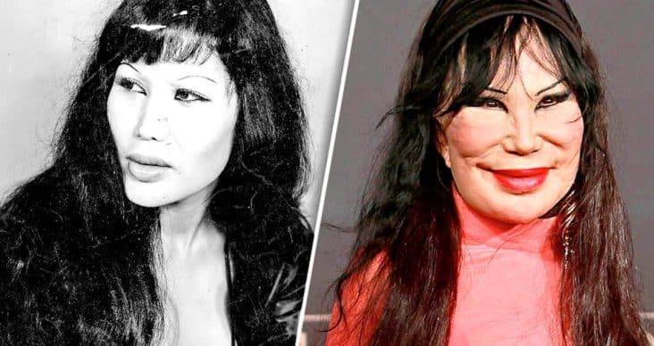 Lyn May and Her Tragic Story That Changed Her Appearance