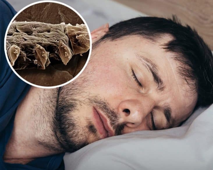 Why Microscopic Parasites Invade Your Face Every Night While You Sleep